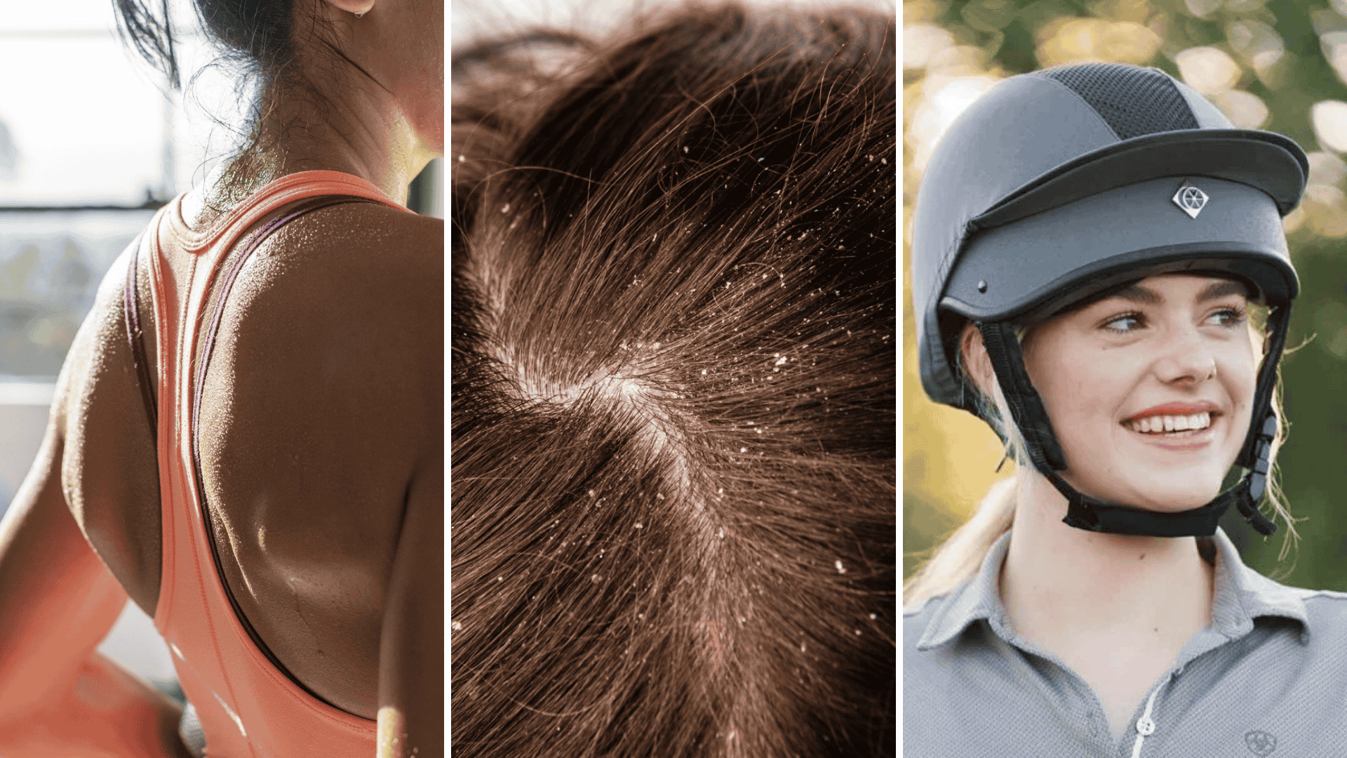 How to Identify and Cure Scalp Pimples Effectively - Style Weekender